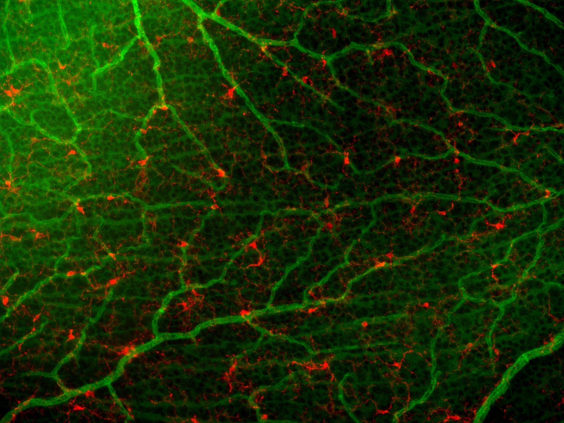 Brunson Center for Translational Vision Research (CTVR) - UCI Office of ...